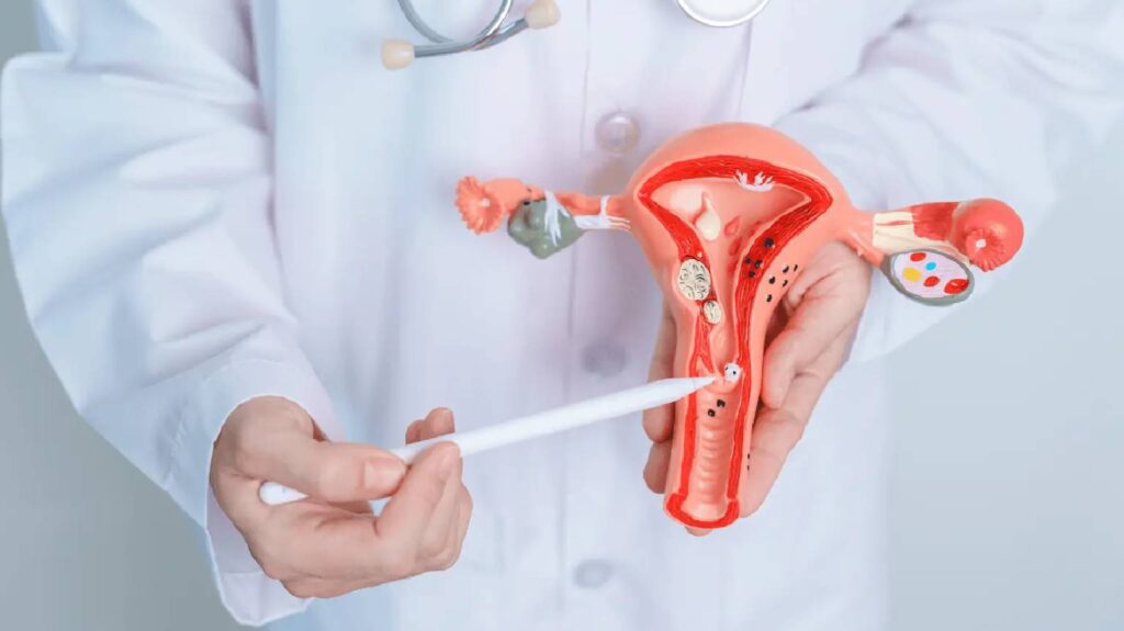 Myomectomy Surgery in Pune | Uterine Fibroid Removal Wakad